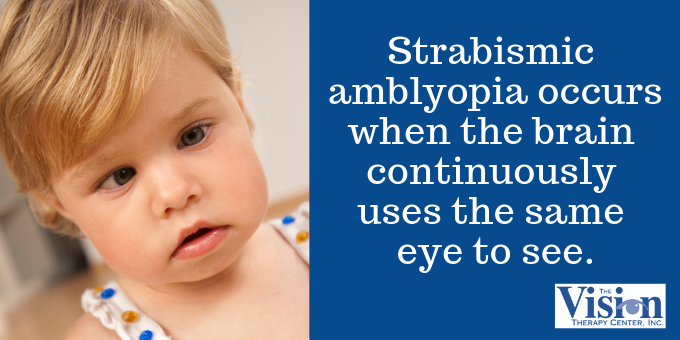 Types of Amblyopia: “Lazy Eye” Can Take on Several Forms