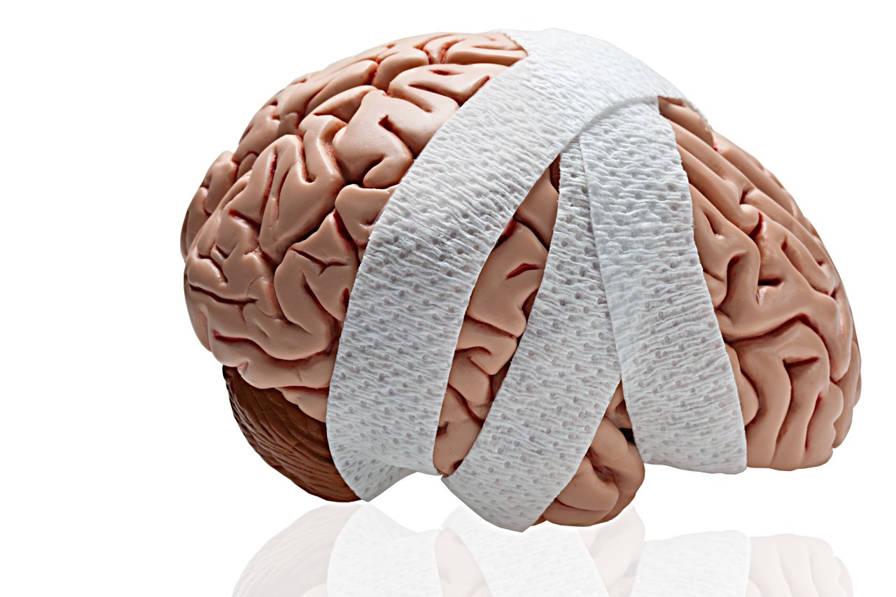 How Brain Injuries Affect The Visual System How Brain Injuries Affect The Visual System